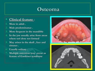 Osteoid Osteoma Jaw