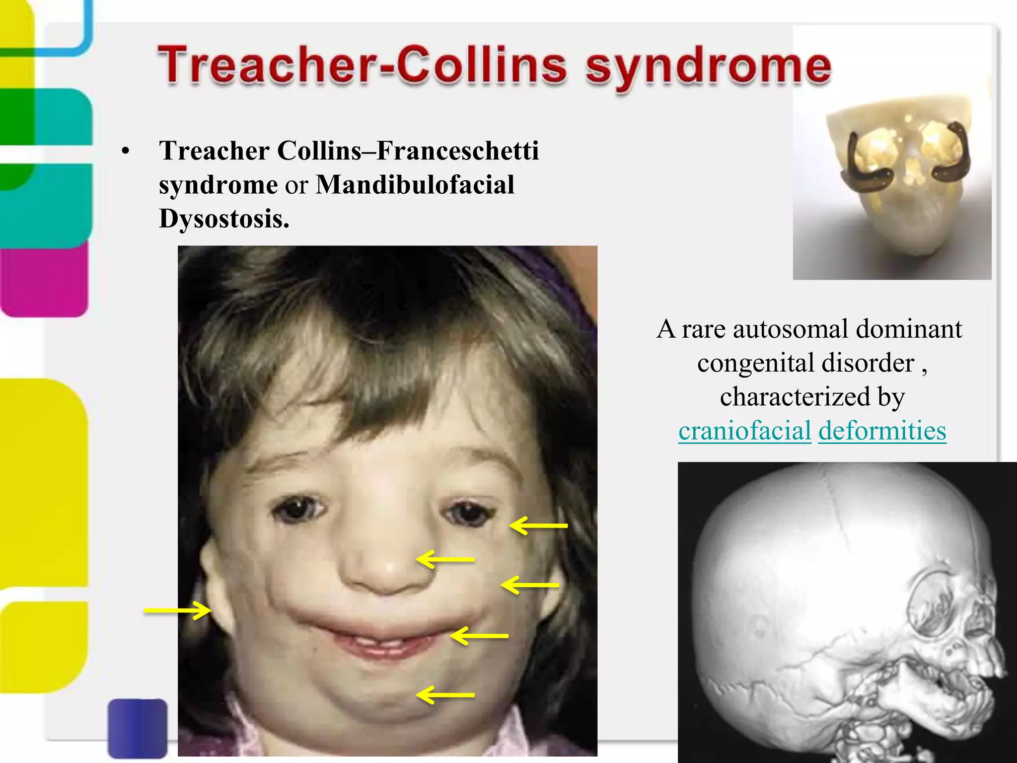 Jaw deformities | PPTX