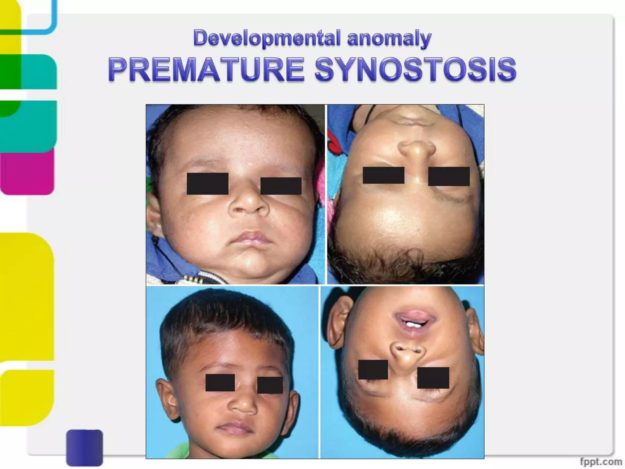 Jaw deformities | PPTX