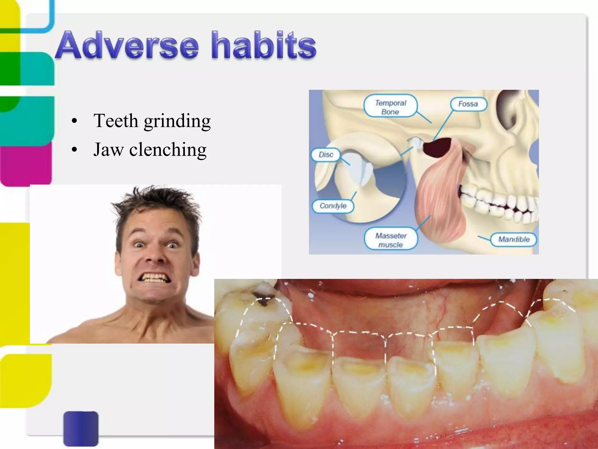 Jaw deformities | PPTX