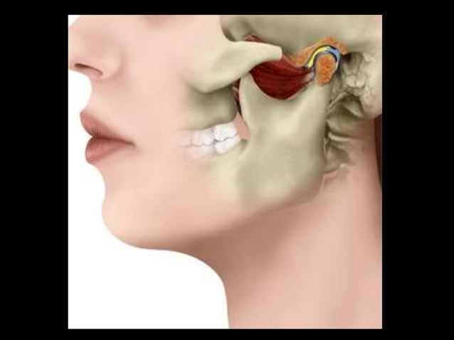 Jaw dislocation | PPTX | First Aid | Injuries
