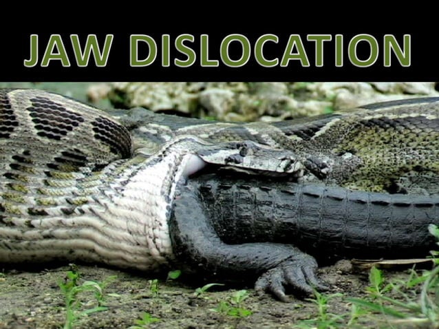 Jaw dislocation | PPTX | First Aid | Injuries