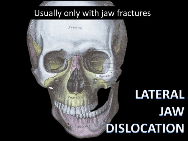 Jaw dislocation | PPTX | First Aid | Injuries