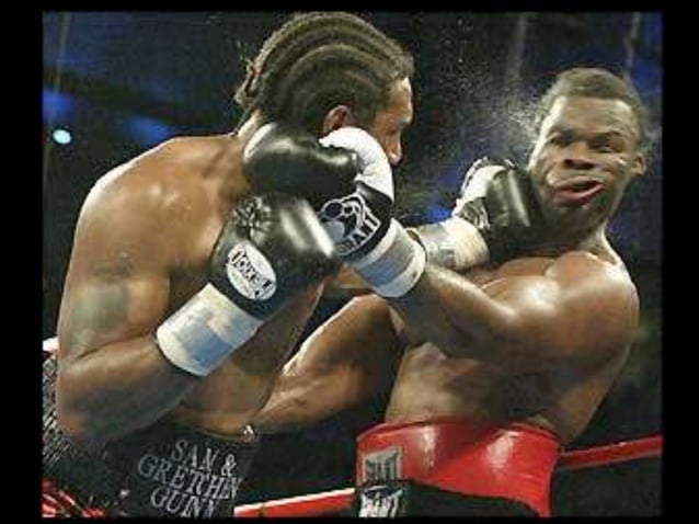 Jaw dislocation | PPTX | First Aid | Injuries