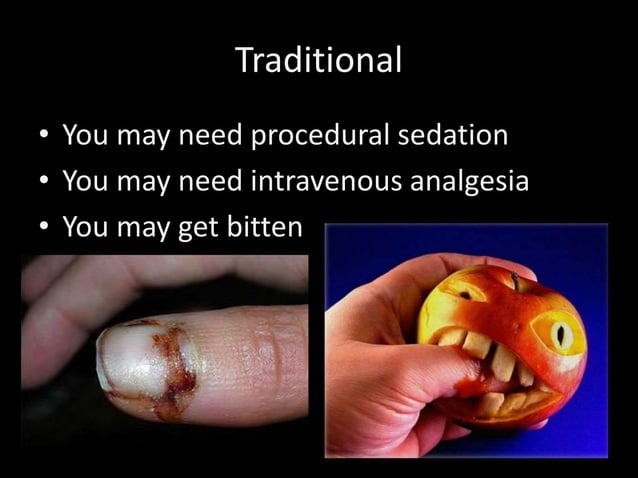 Jaw dislocation | PPTX | First Aid | Injuries