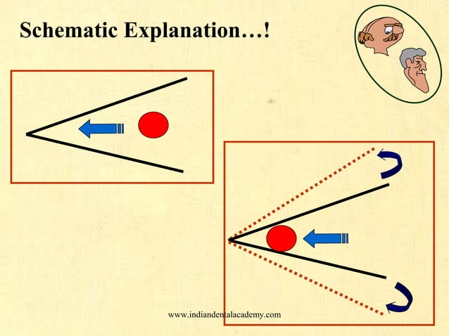 Jaw geometry (2) | PPT