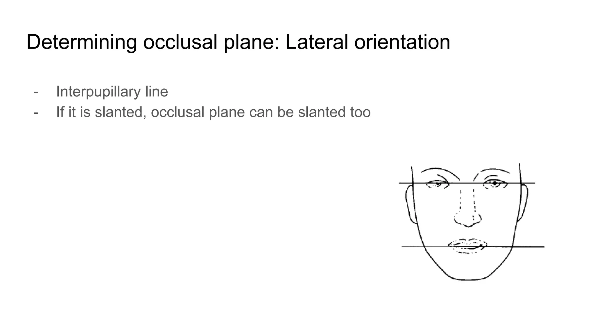 Jaw registration.pptx