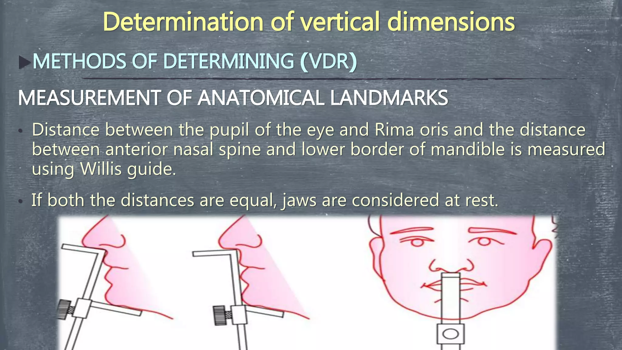 Jaw relation-prosthesis | PPTX