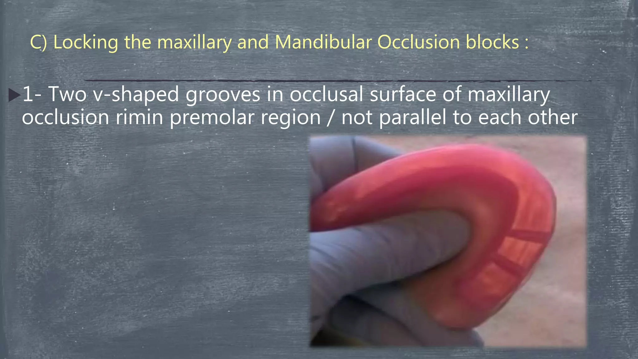 Jaw relation-prosthesis | PPTX