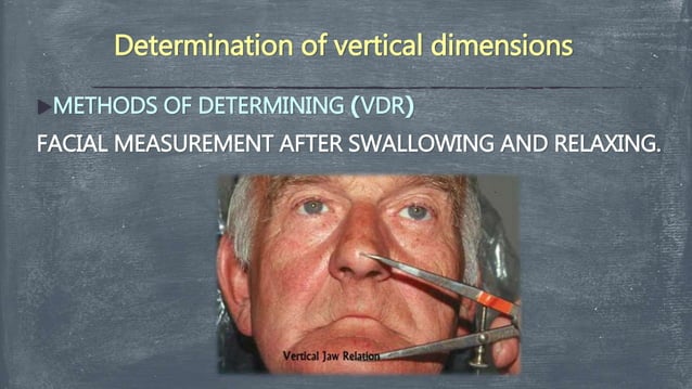 Jaw relation-prosthesis | PPTX