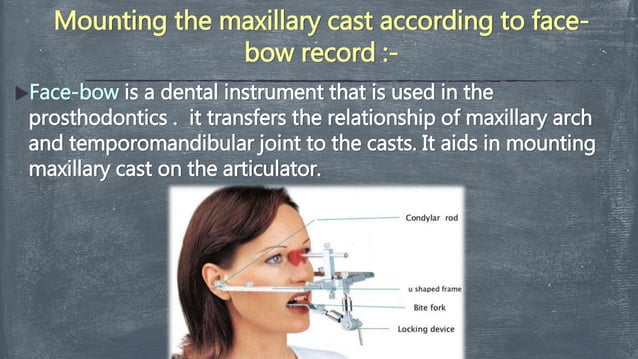Jaw relation-prosthesis | PPTX