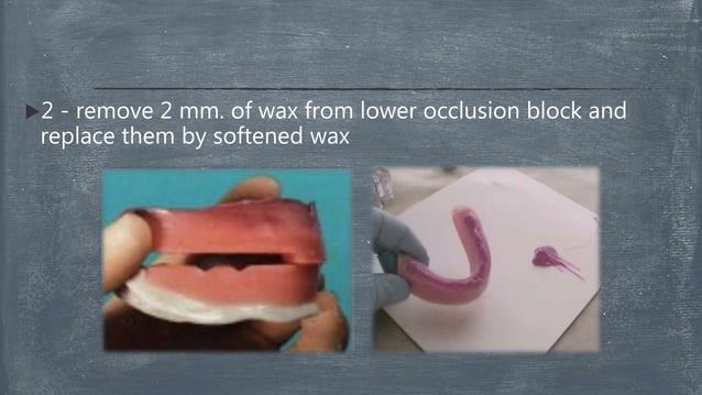 Jaw relation-prosthesis | PPTX