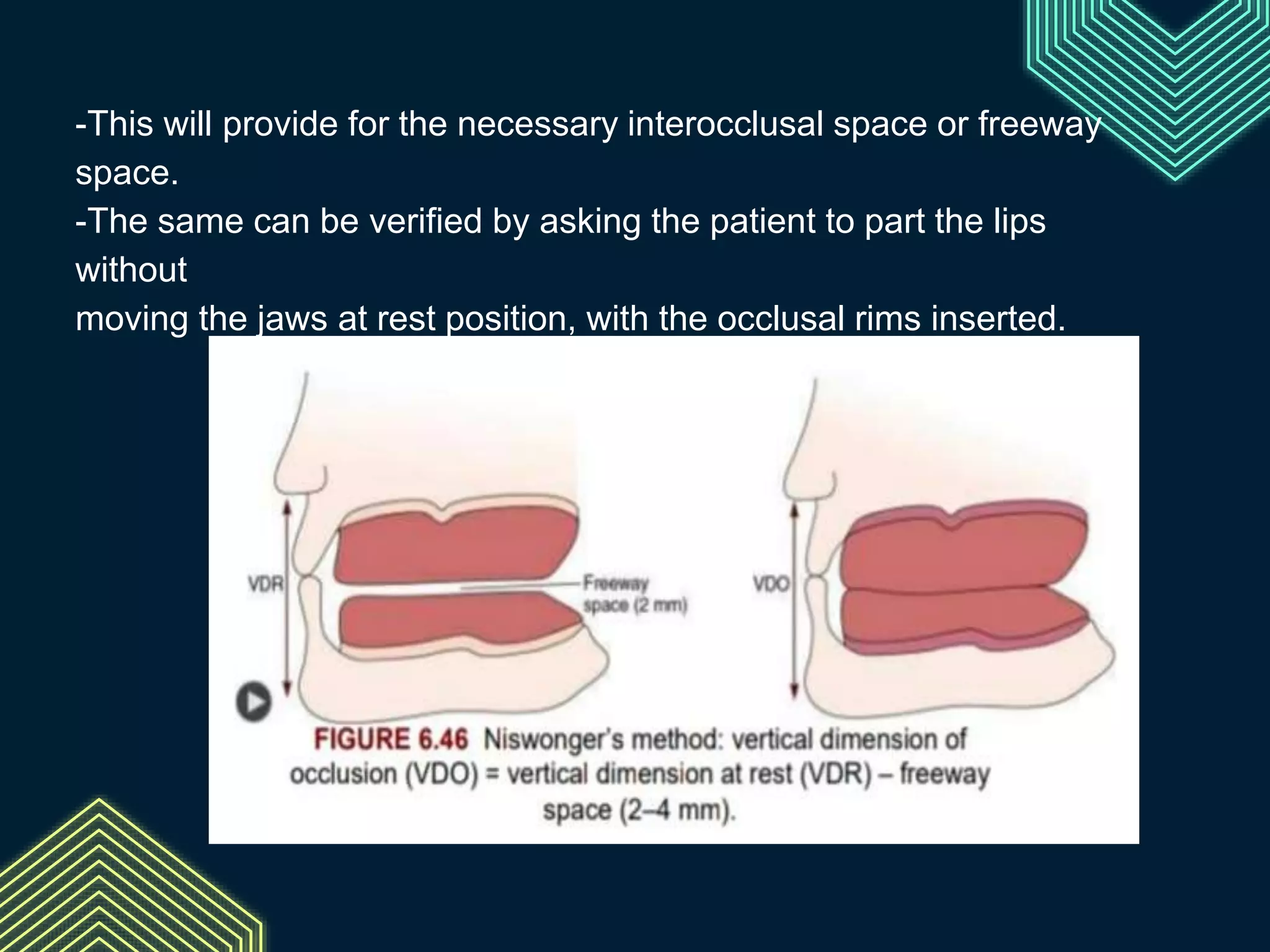 Jaw relation | PPTX