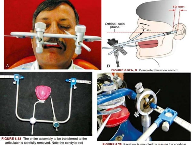 Jaw relation | PPTX | Dental Health | Diseases and Conditions