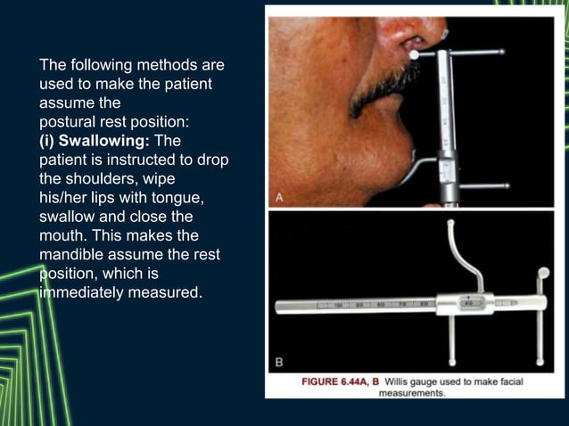 Jaw relation | PPTX | Dental Health | Diseases and Conditions