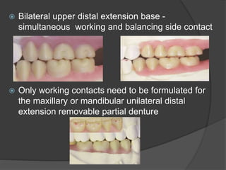 Jaw relation in rpd | PPTX