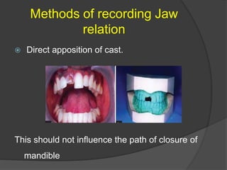 Jaw relation in rpd | PPTX