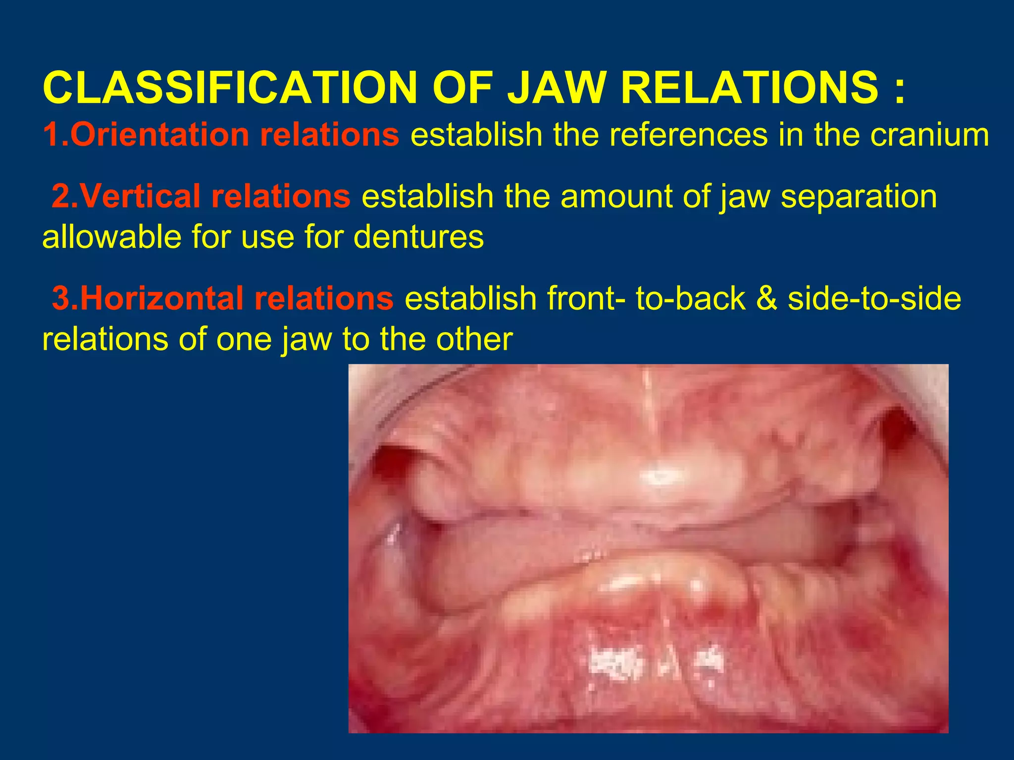 Jaw relation | PPT