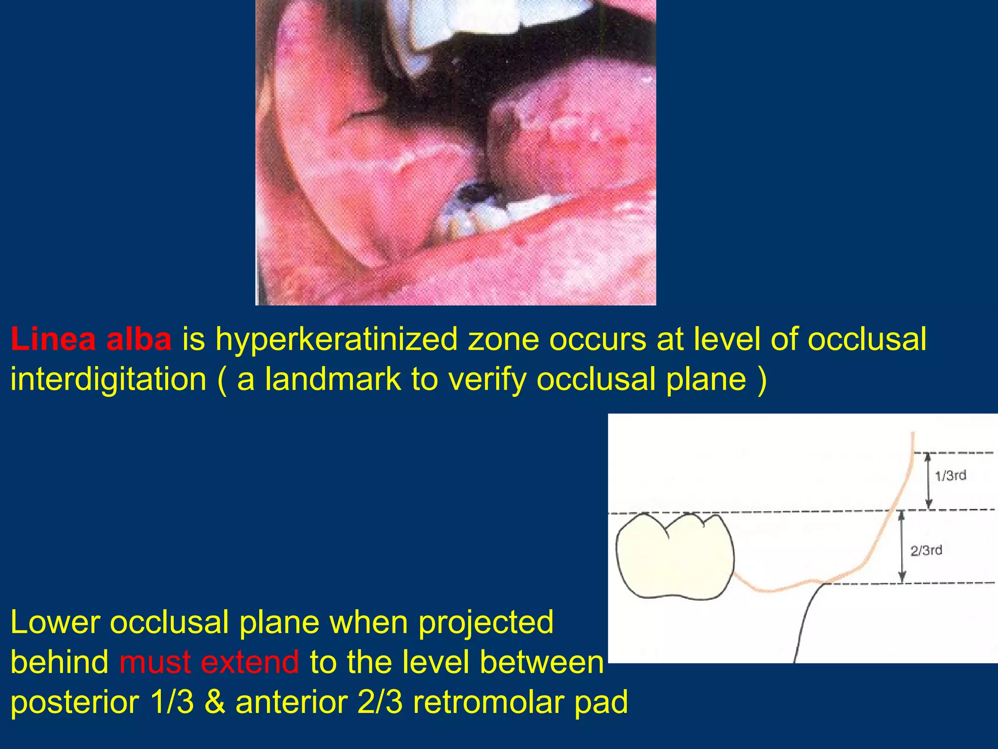 Jaw relation | PPT