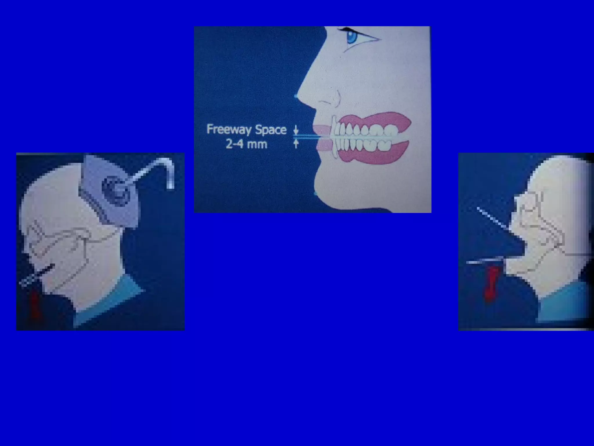 Jaw relation | PPT