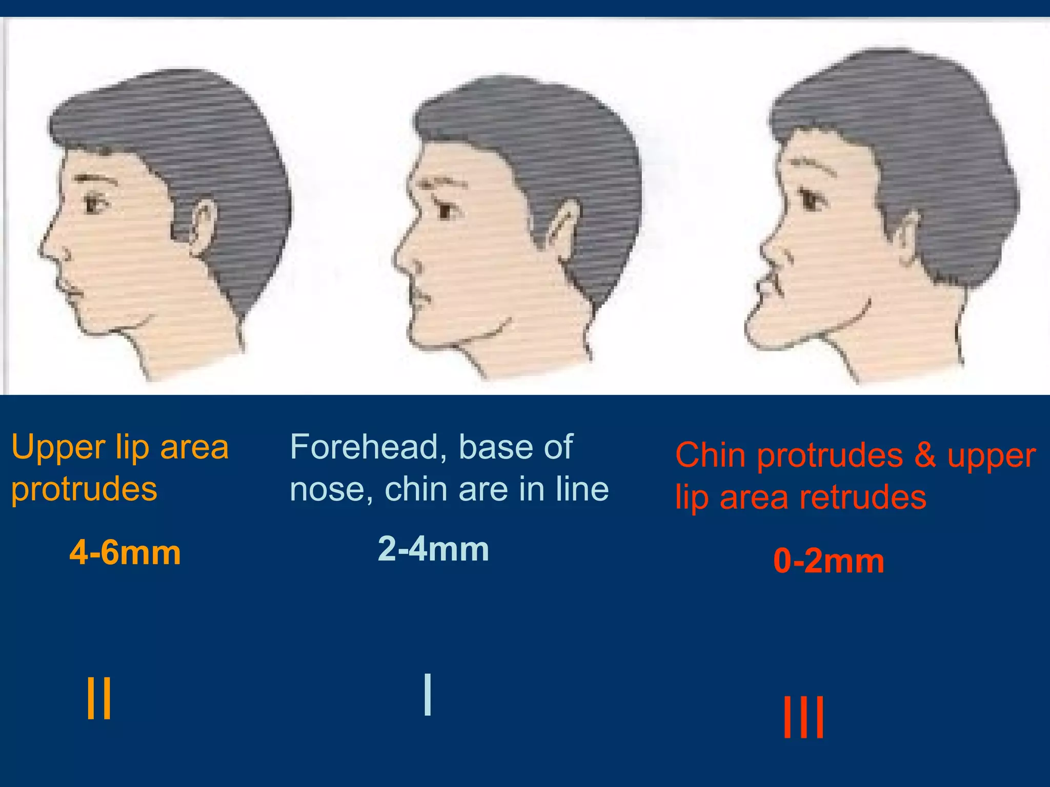 Jaw relation | PPT