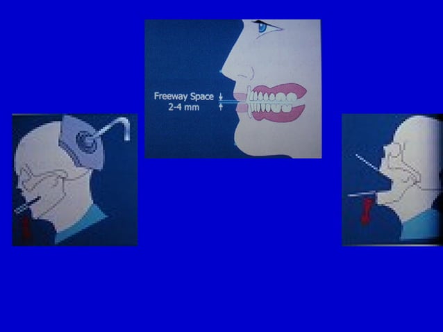 Jaw relation | PPT | Dental Health | Diseases and Conditions