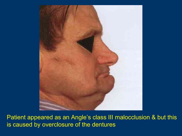 Jaw relation | PPT | Dental Health | Diseases and Conditions