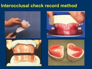 Jaw relation | PPT