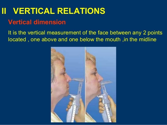 Jaw relation