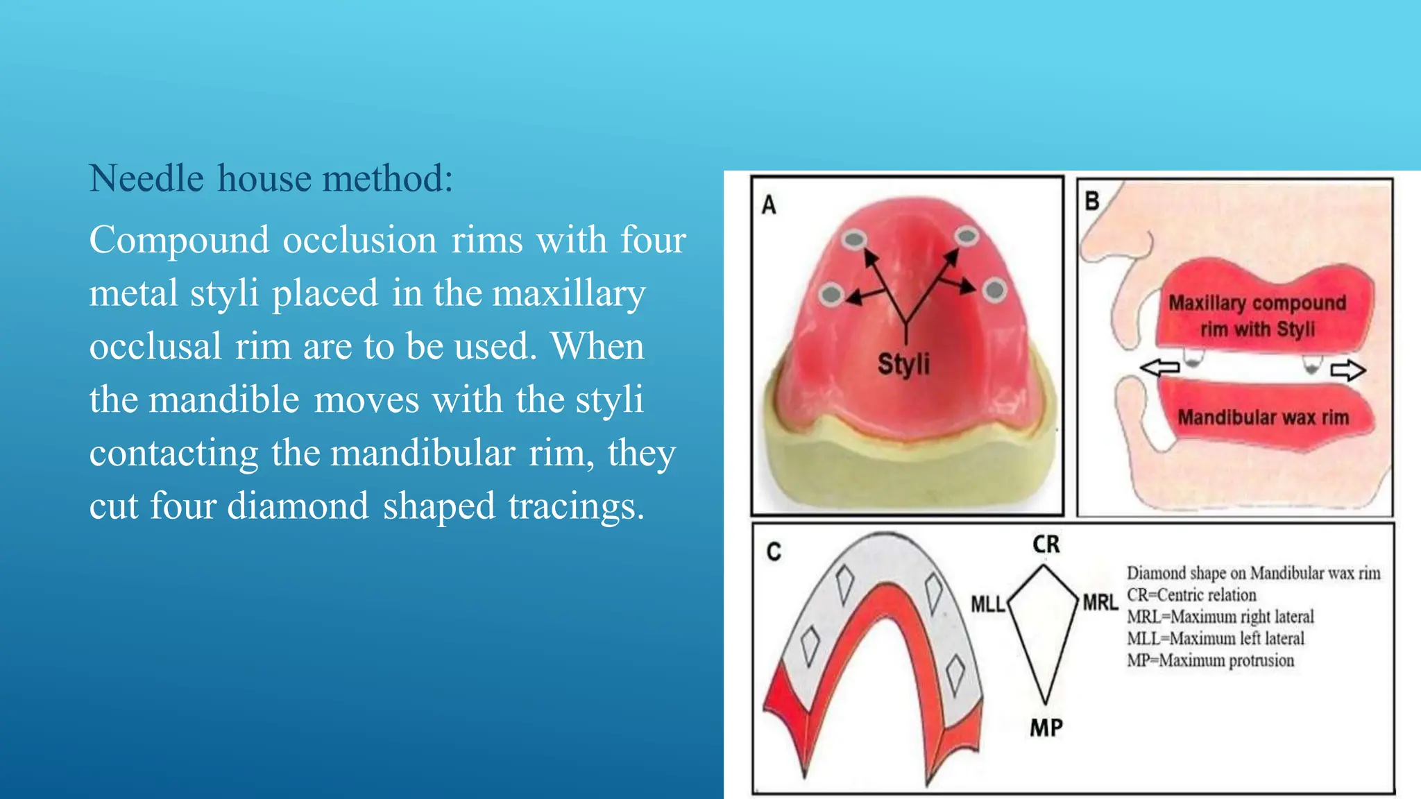 jaw relation in complete and partial denture | PPTX