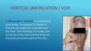 jaw relation in complete and partial denture | PPTX