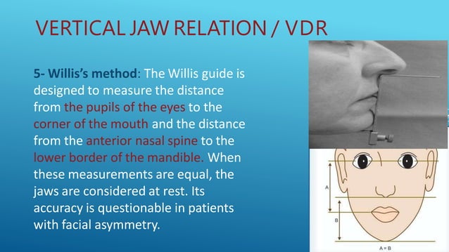 jaw relation in complete and partial denture | PPTX | Dental Health ...