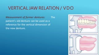 jaw relation in complete and partial denture | PPTX