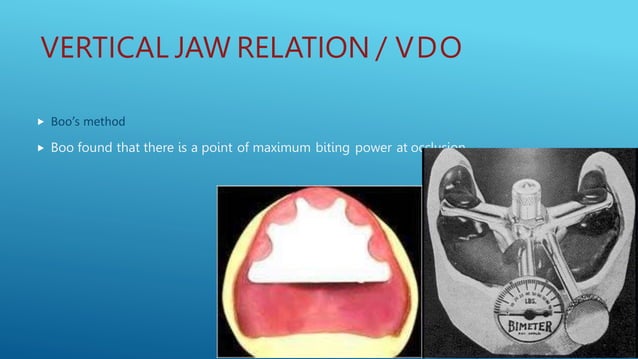 jaw relation in complete and partial denture | PPTX | Dental Health ...