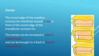 jaw relation in complete and partial denture | PPTX