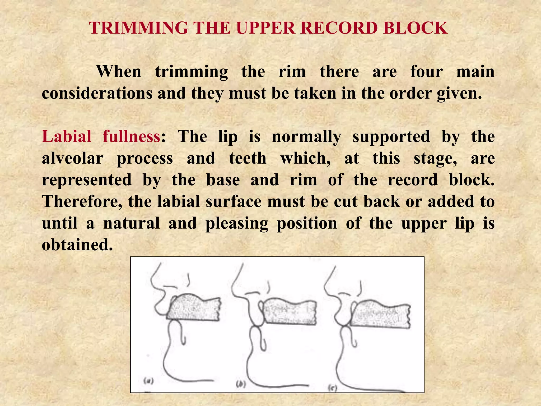 Jaw Relations in CD.ppt