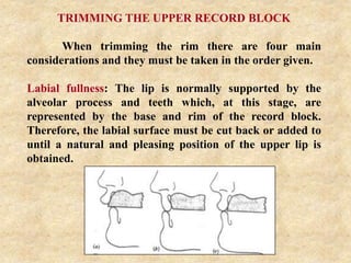 Jaw Relations in CD.ppt