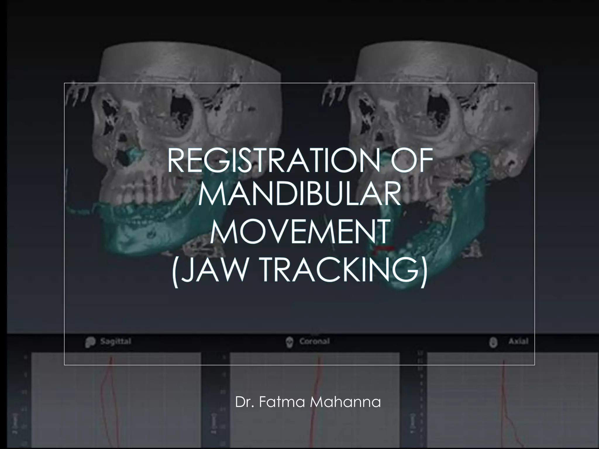 Registration of Mandibular movements .pdf