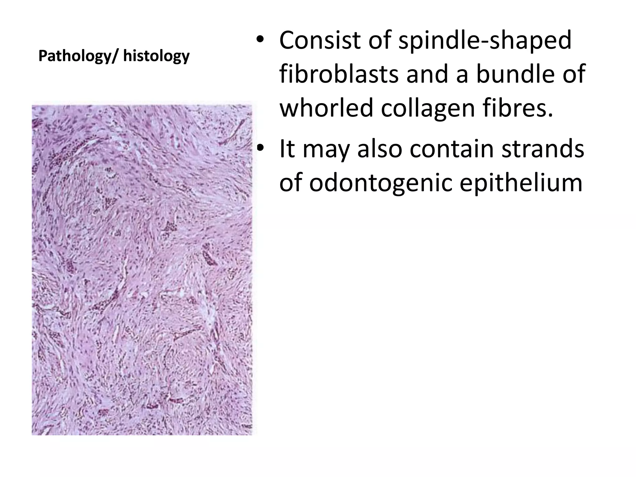 Jaw tumors beningn and malignant | PPTX