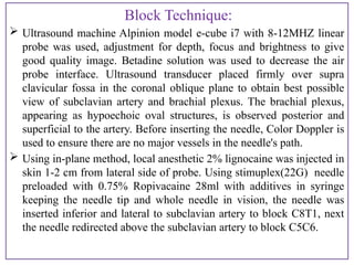 A Comparative Study of Dexmedetomidine vs Clonidine as Adjuvants to ...
