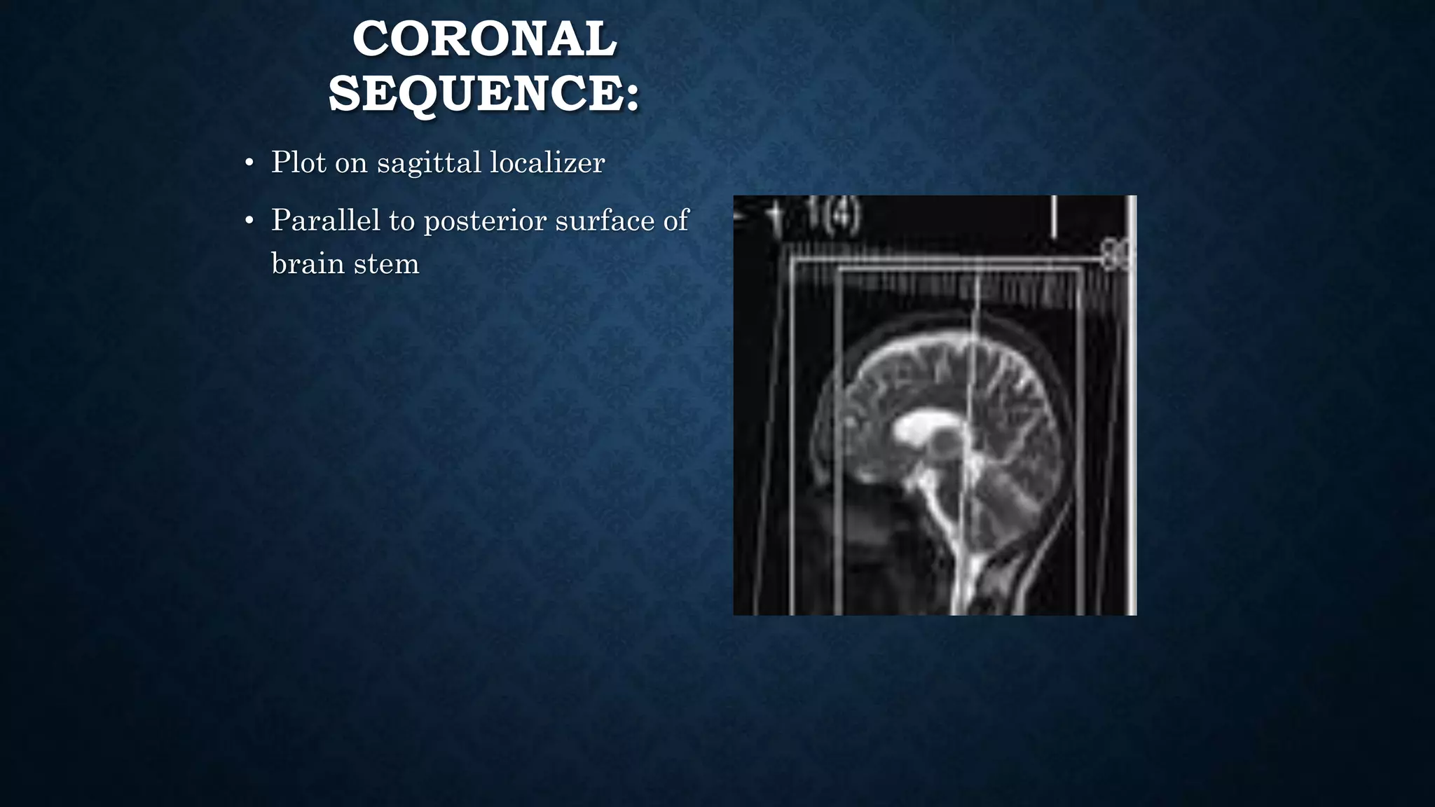 MRI Brain | PPTX