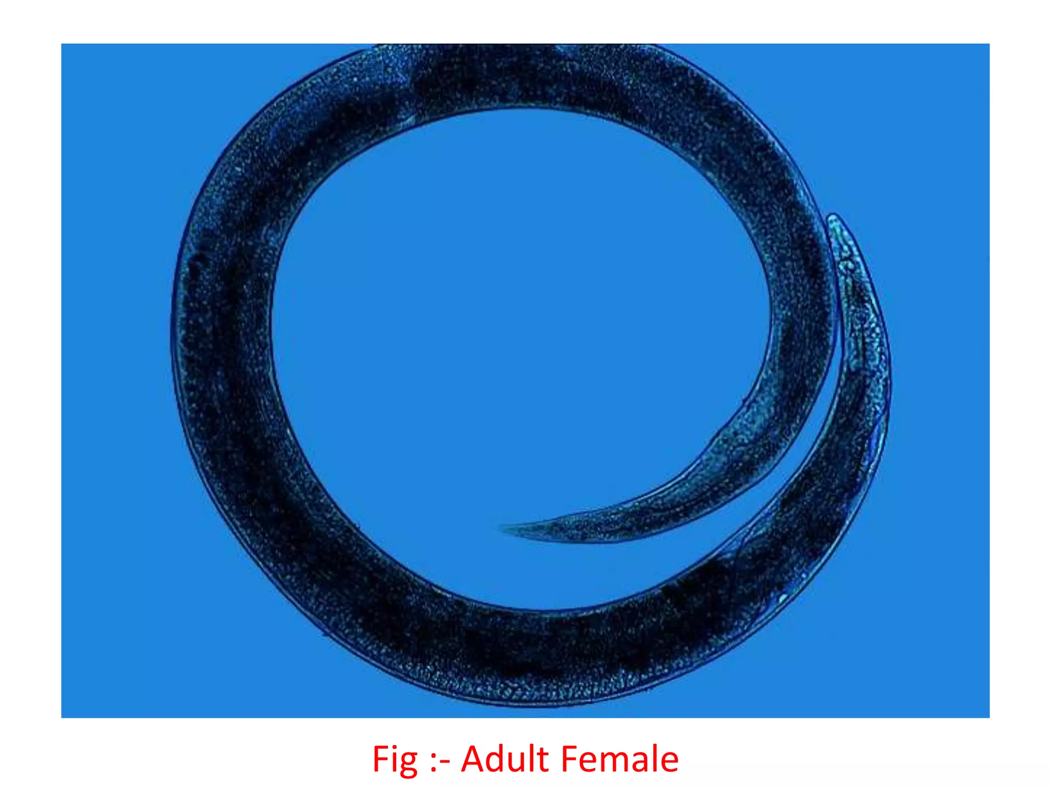 Ear cockle and yellow ear rot diseases of wheat | PPTX
