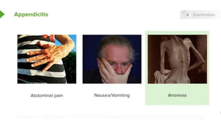Appendicitis | PPT