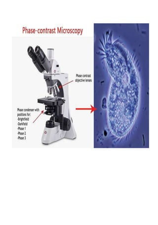 Phase contrast Microscopy | DOCX