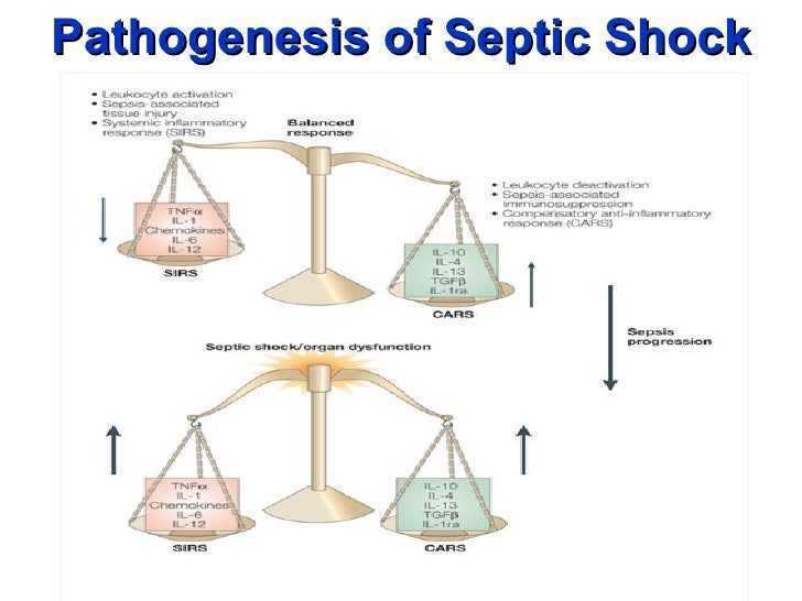 Sepsis Cascade Made Easy