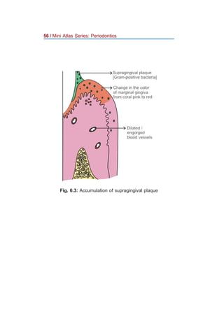 Jaypee mini atlas series periodontics | PDF