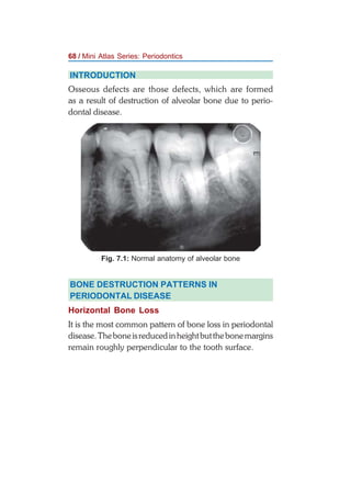 Jaypee mini atlas series periodontics | PDF