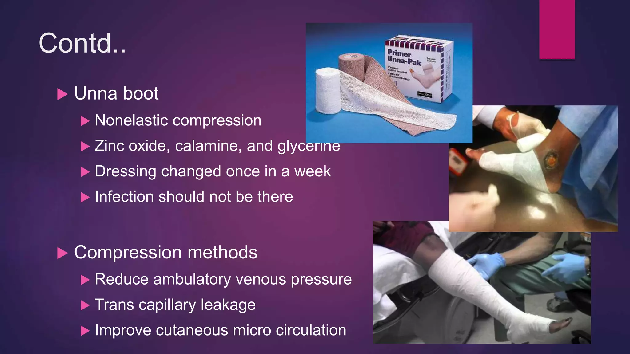 Varicose Vein | PPTX