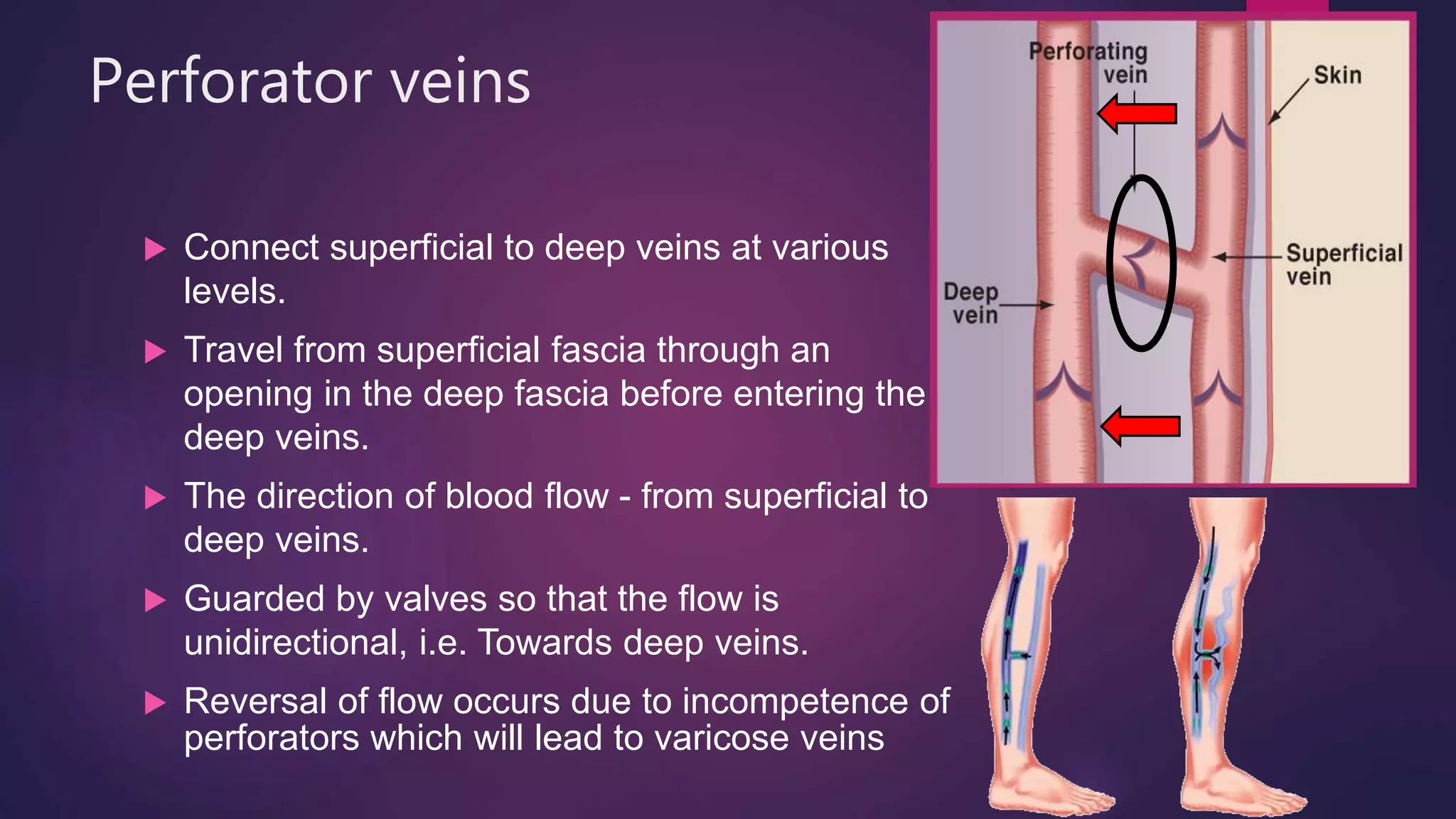 Varicose Vein | PPTX