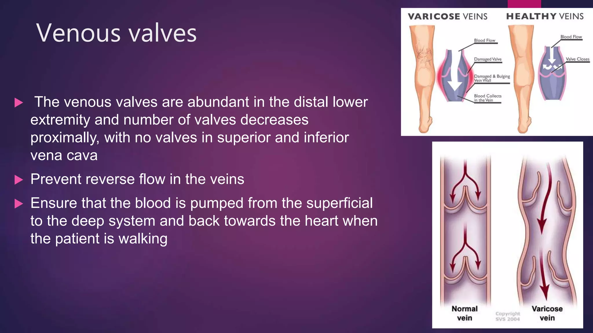 Varicose Vein | PPTX